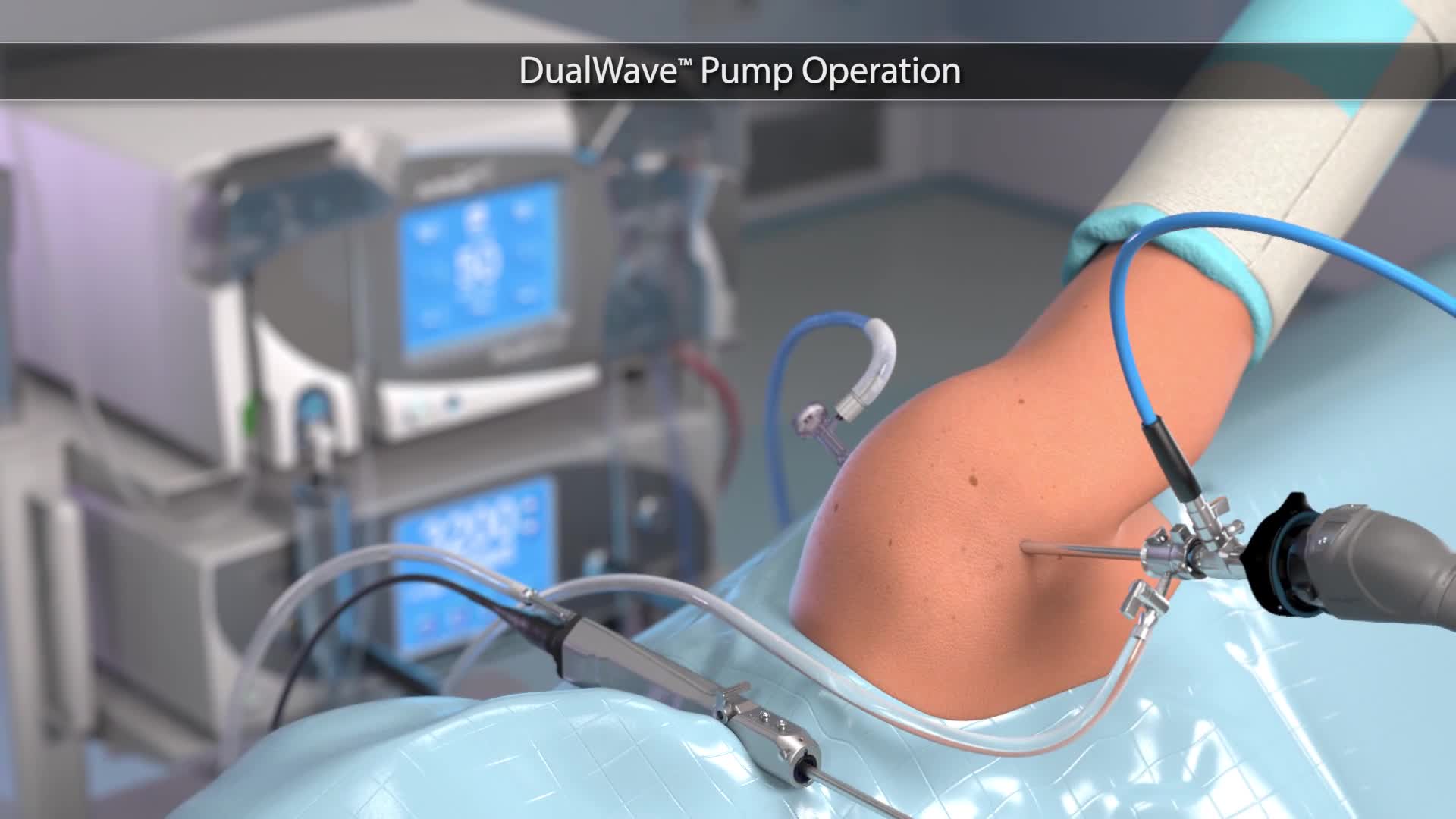 Arthrex - DualWave™ Pump Operation