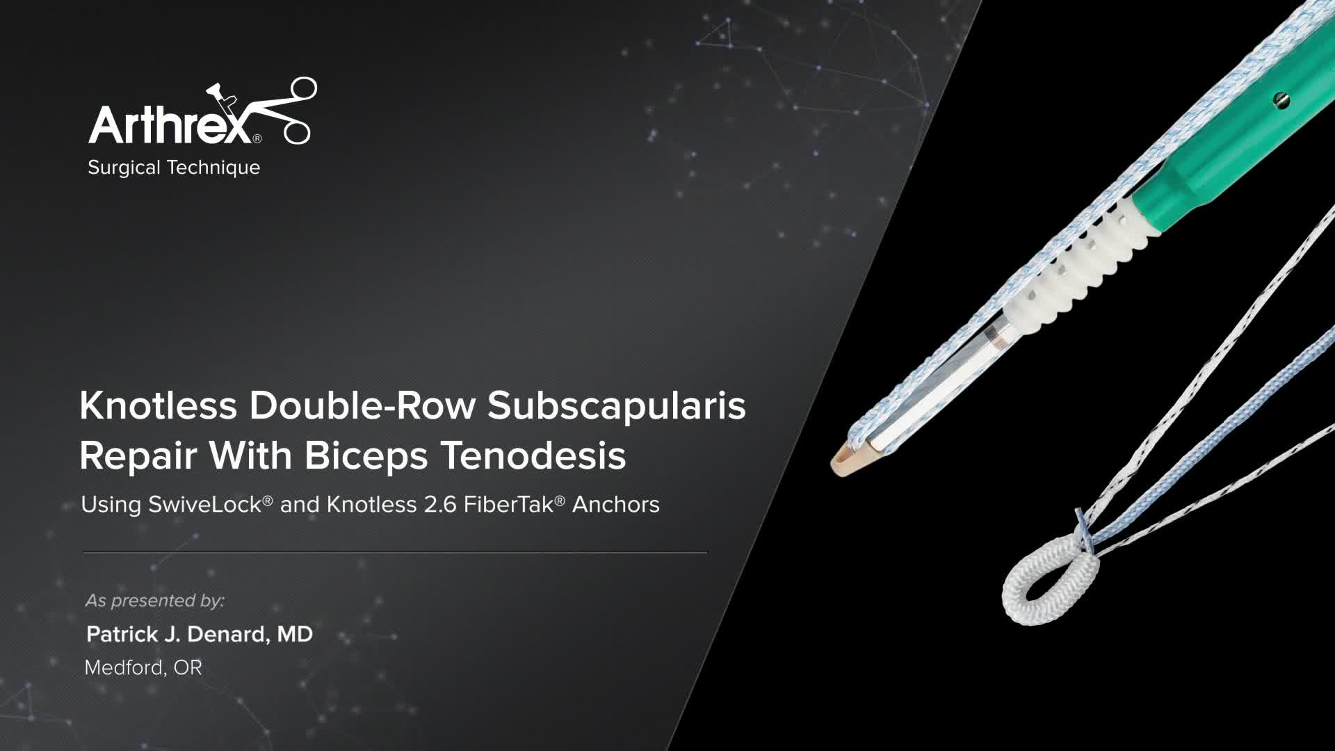 Arthrex - Knotless Double-Row Subscapularis Repair With Biceps ...