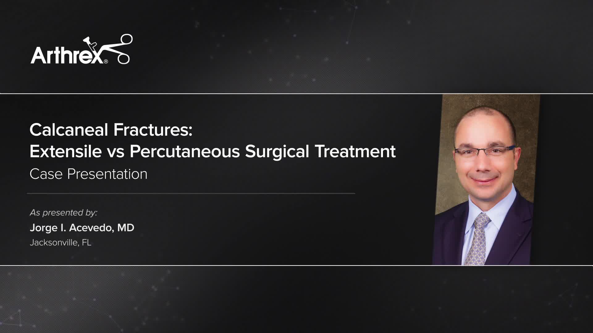 Arthrex Calcaneal Fractures Extensile Vs Percutaneous Surgical Treatment