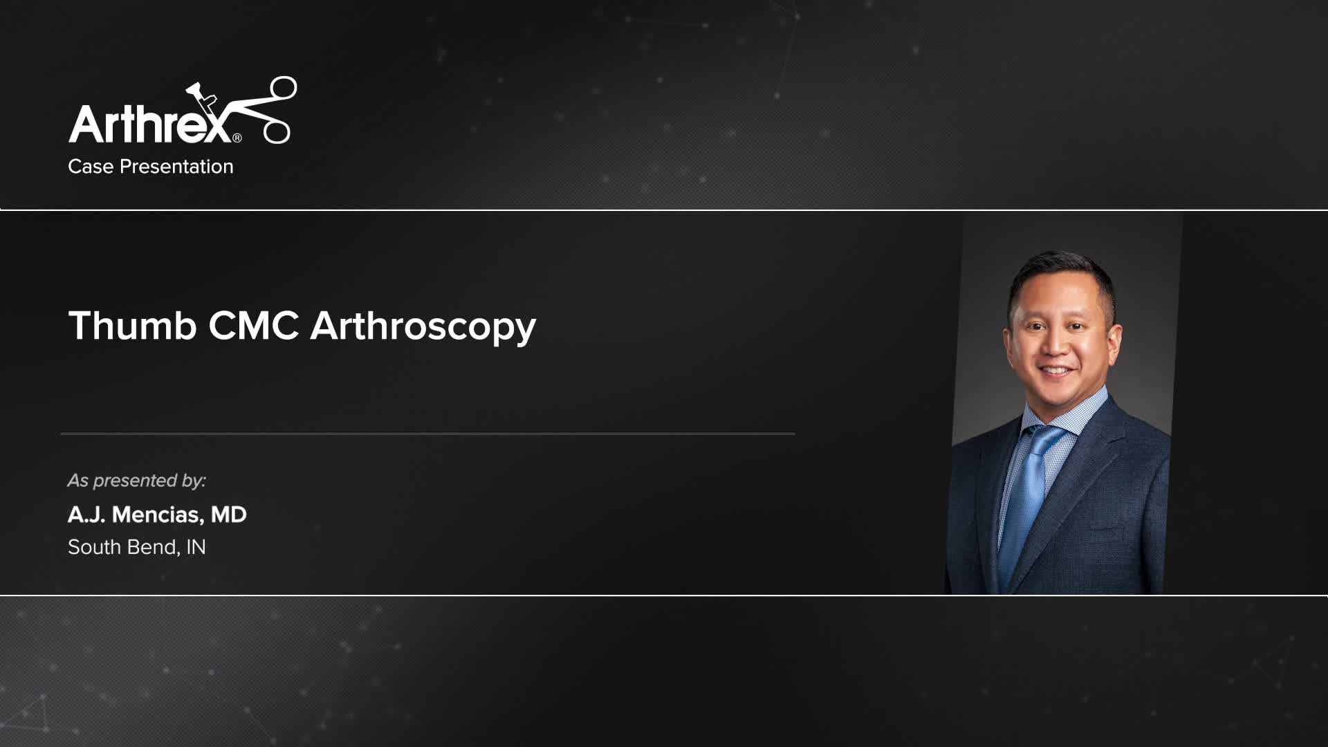 Arthrex - Thumb CMC Arthroscopy