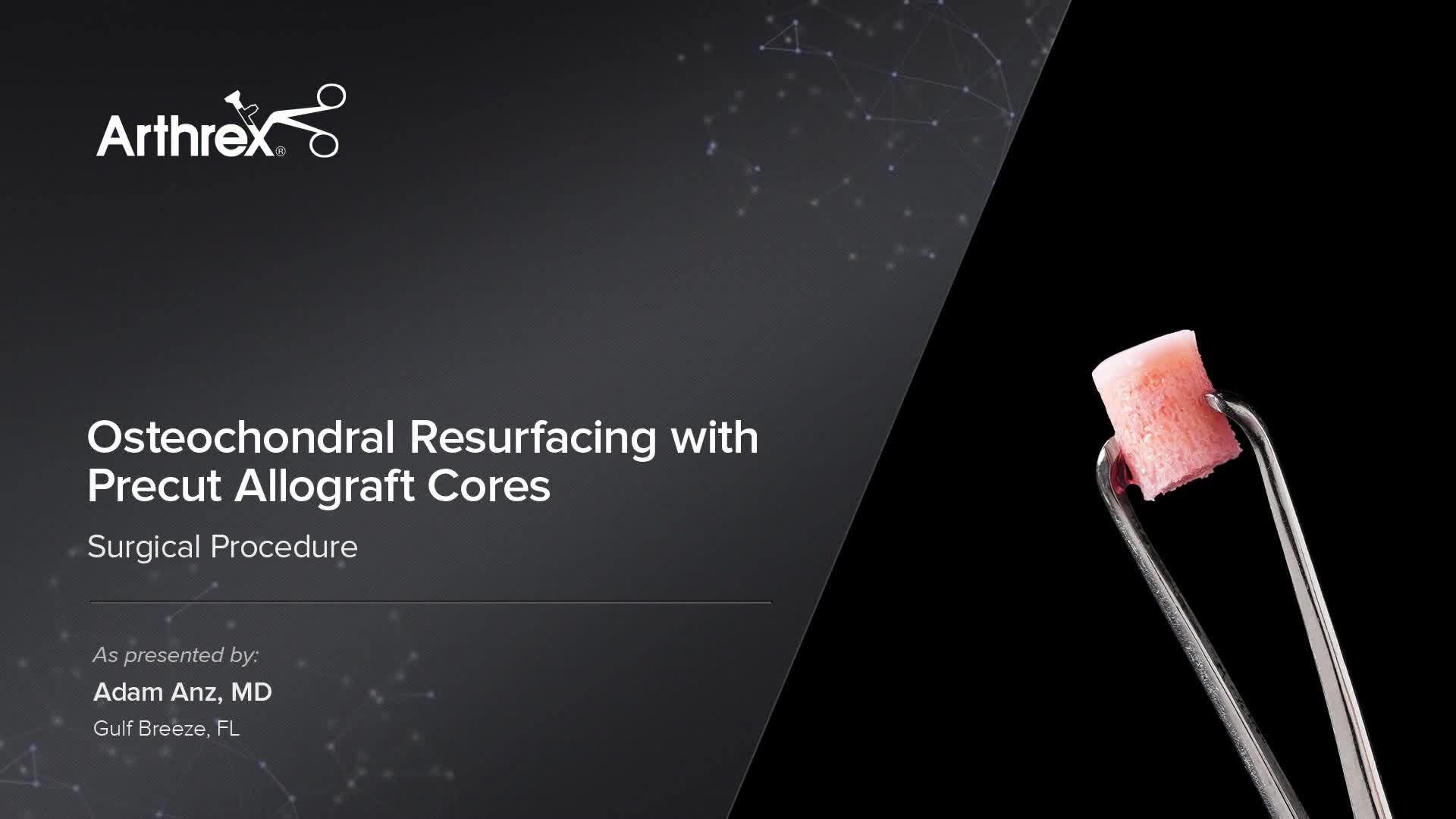 Arthrex - Osteochondral Resurfacing with Precut Allograft Cores