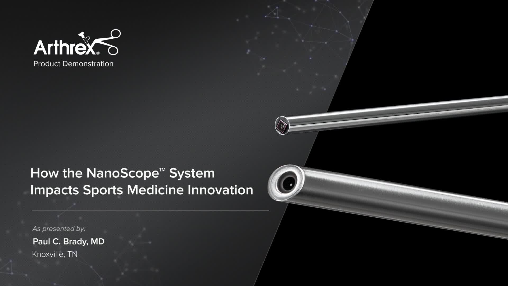 Arthrex - How the NanoScope™ System Impacts Sports Medicine Innovation
