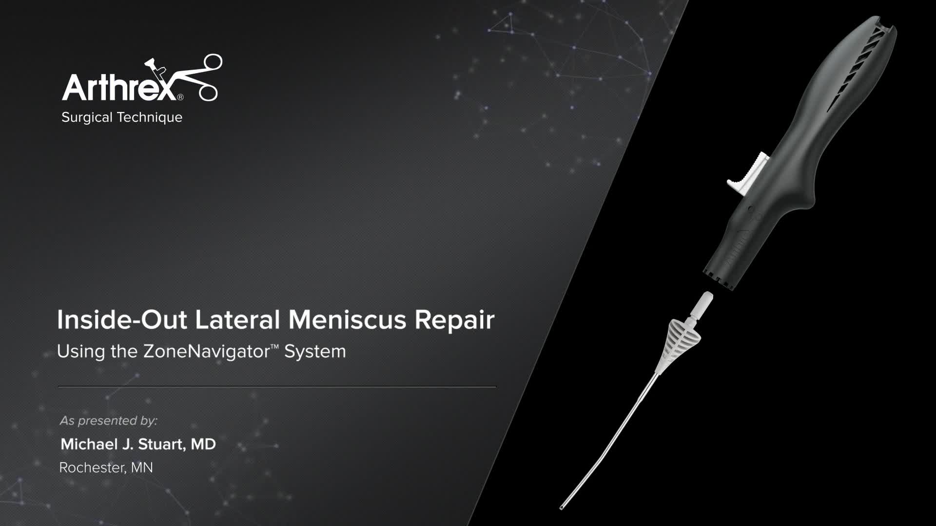 Arthrex - Inside-Out Lateral Meniscus Repair Using the ZoneNavigator ...