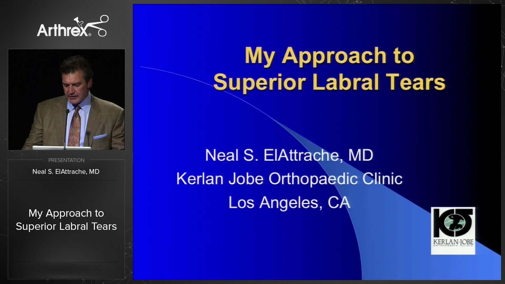 Arthrex - My Approach to Superior Labral Tears