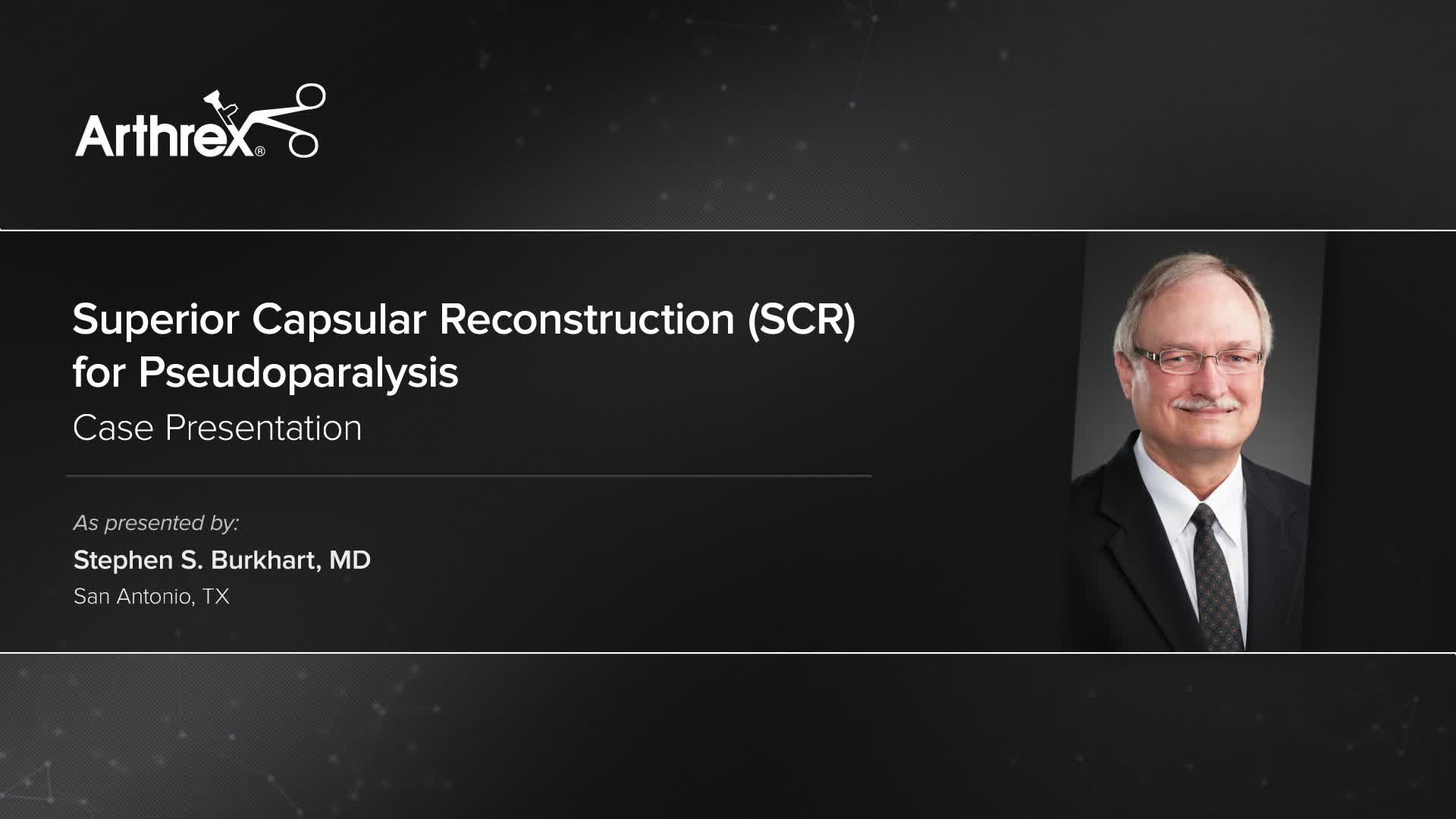 Arthrex - Superior Capsular Reconstruction (SCR) for Pseudoparalysis