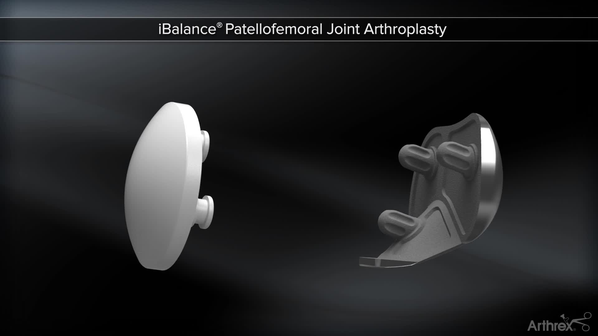 Arthrex - iBalance® Patellofemoral Joint Arthroplasty