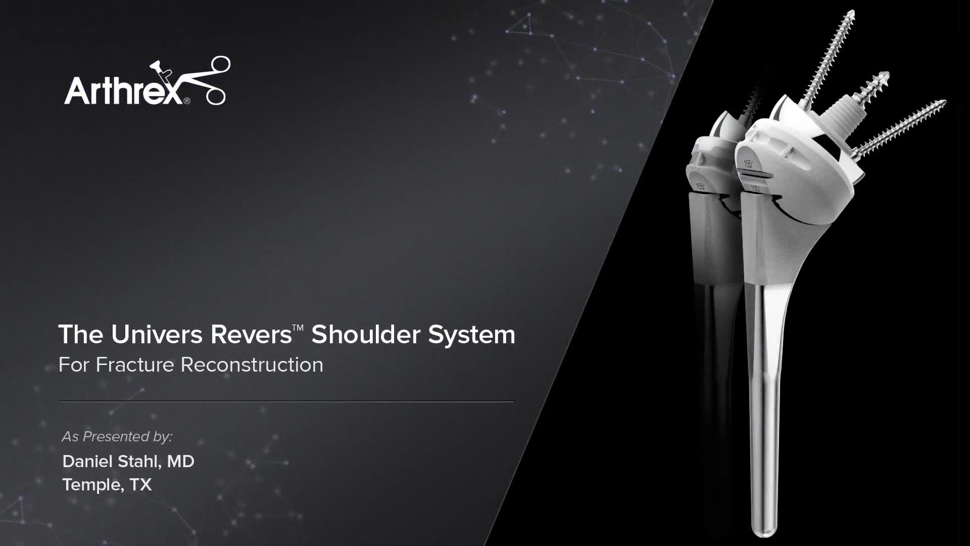 Arthrex - The Univers Revers™ Shoulder System For Fracture Reconstruction