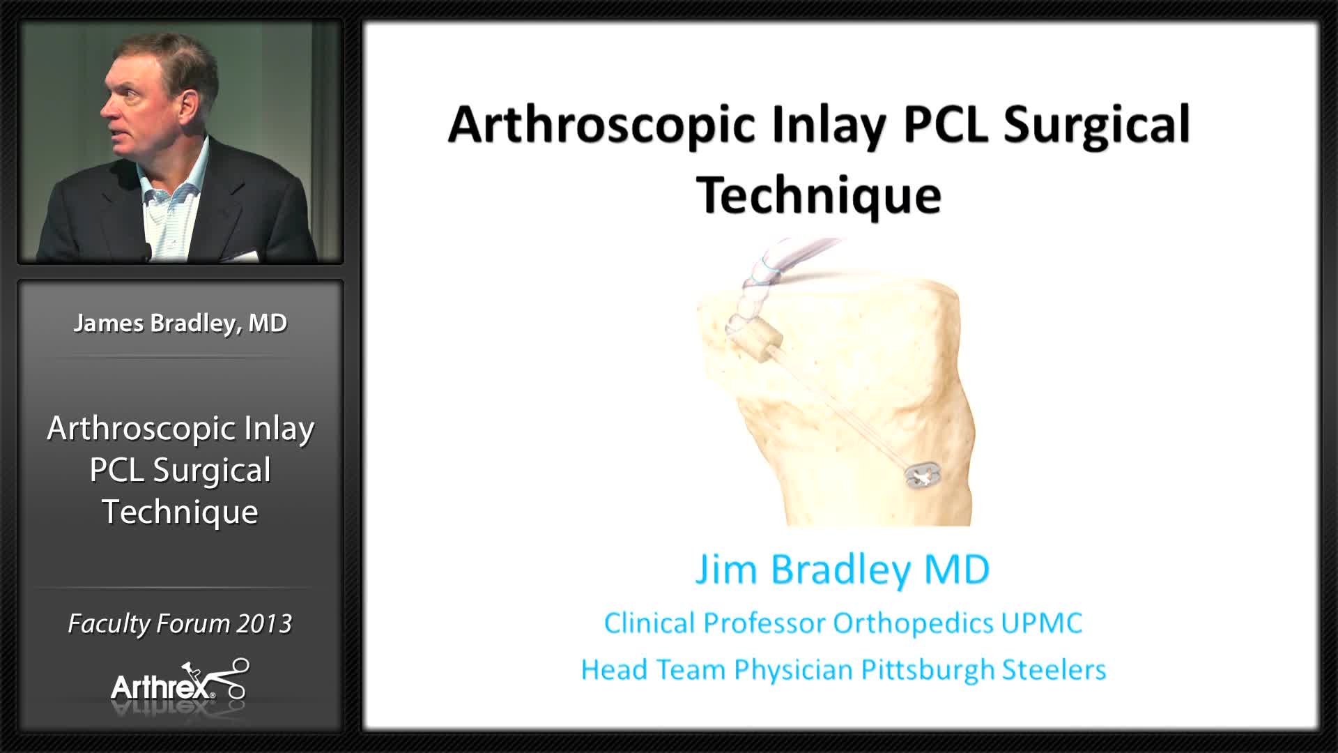 Arthrex - Arthroscopic Inlay PCL Surgical Technique