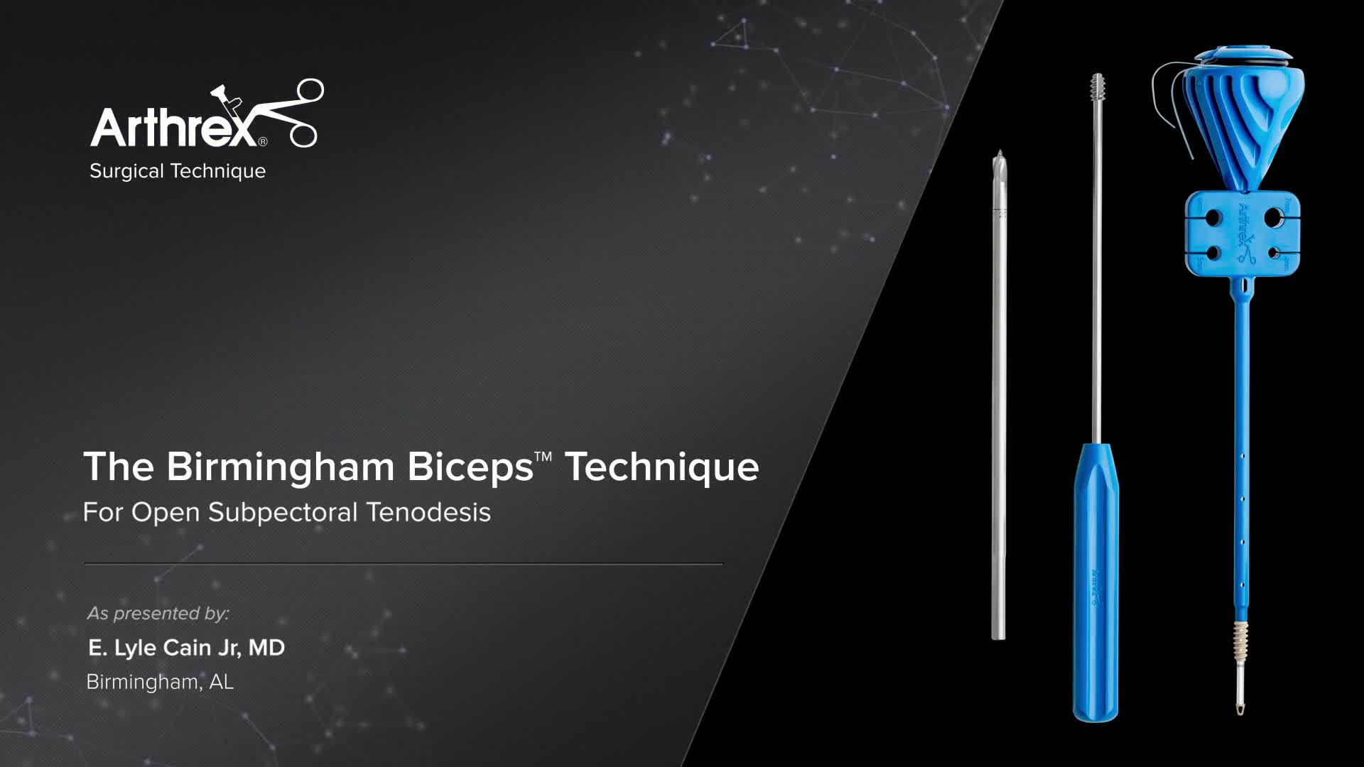 Arthrex - The Birmingham Biceps™ Technique For Open Subpectoral Tenodesis