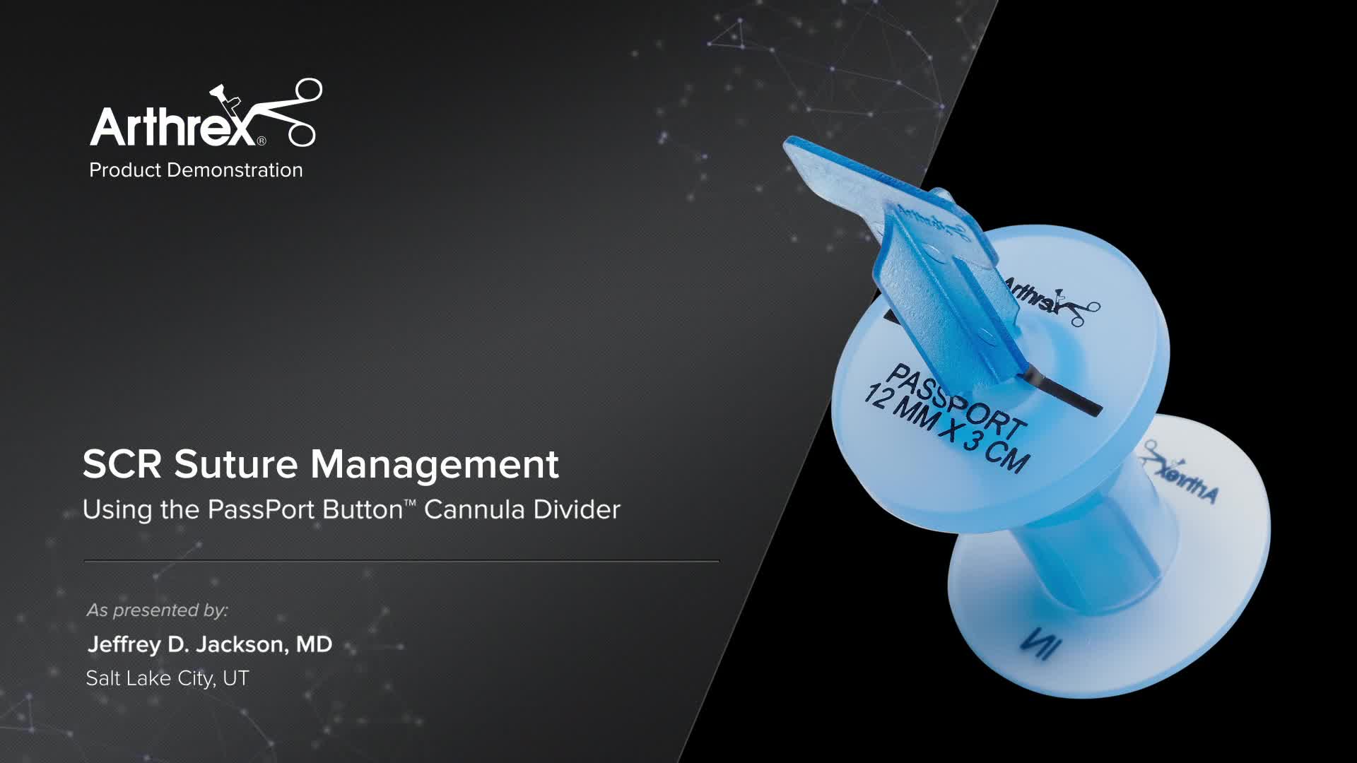 Arthrex - SCR Suture Management Using the PassPort Button™ Cannula Divider