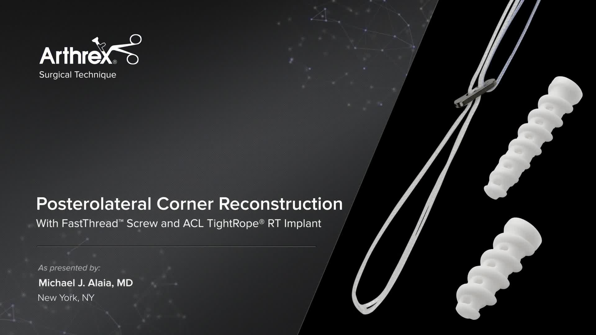 Arthrex - Posterolateral Corner Reconstruction With FastThread™ Screw ...