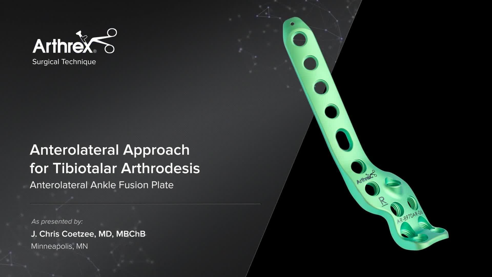 Arthrex - Anterolateral Approach for Tibiotalar Arthrodesis ...