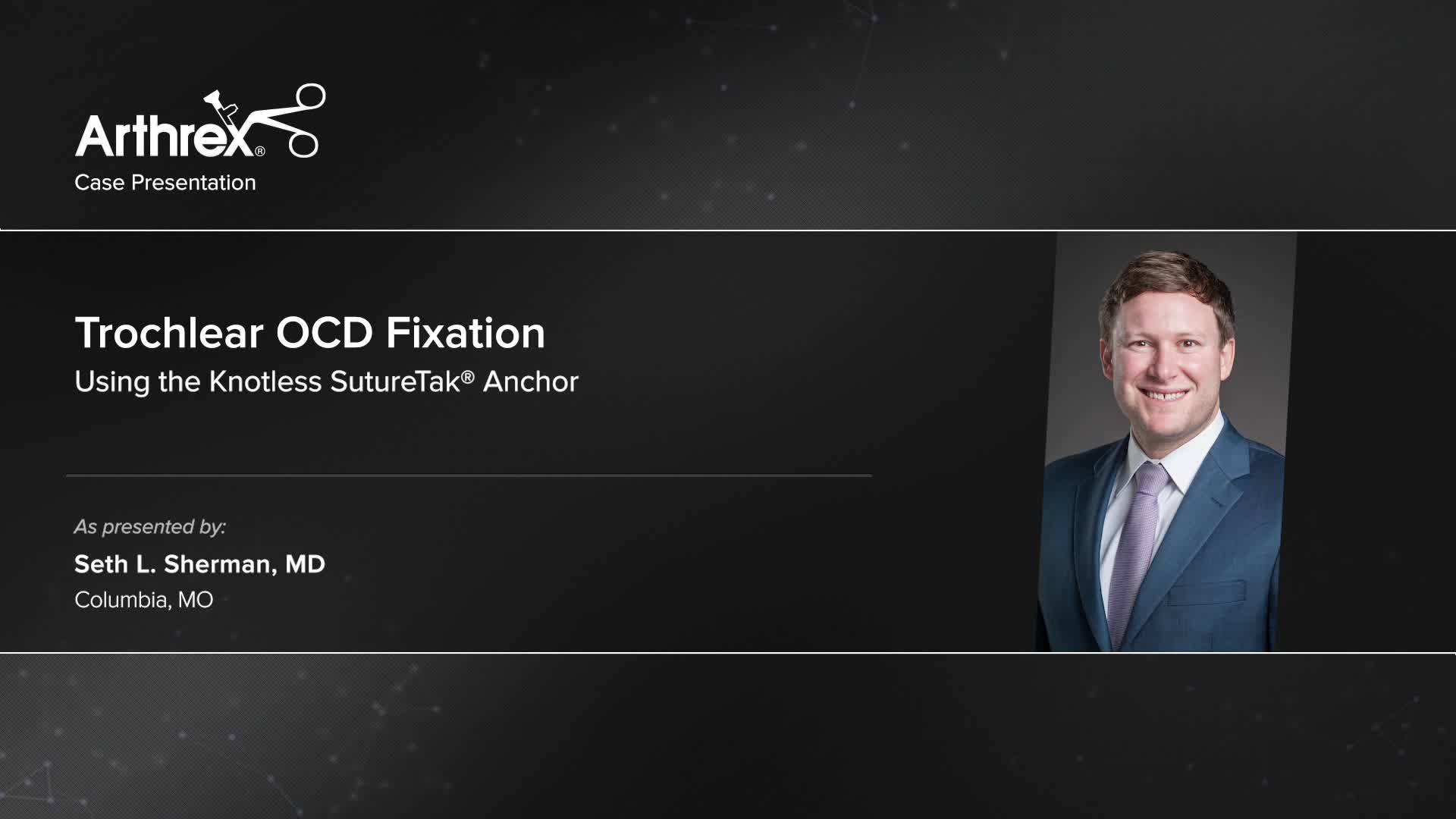 Arthrex - Trochlear OCD Fixation Using the Knotless SutureTak® Anchor