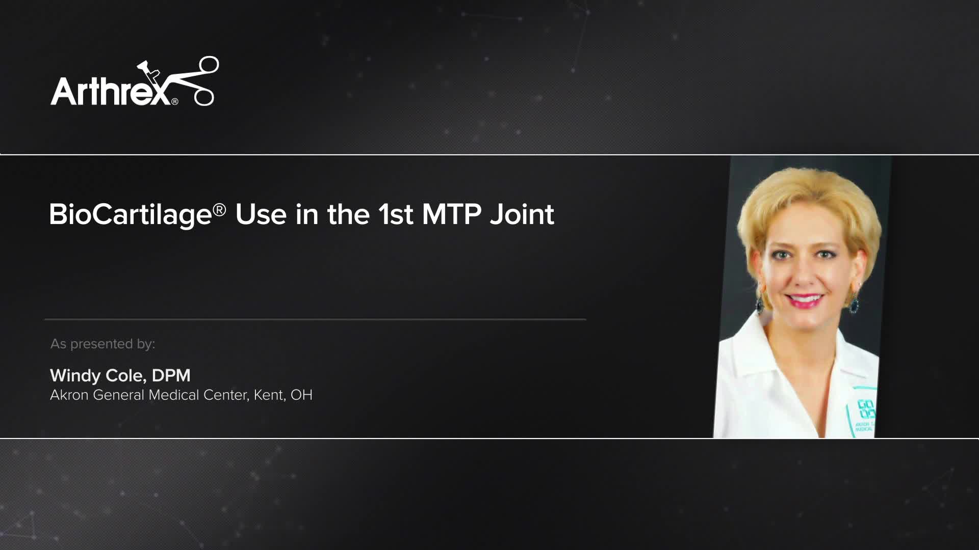 Arthrex - BioCartilage® Use in the 1st MTP Joint