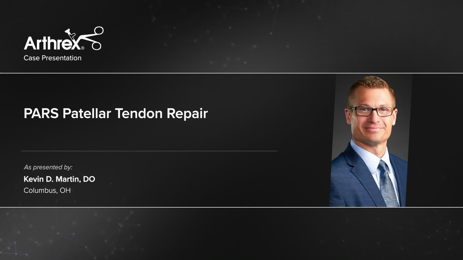 Arthrex - PARS Patellar Tendon Repair
