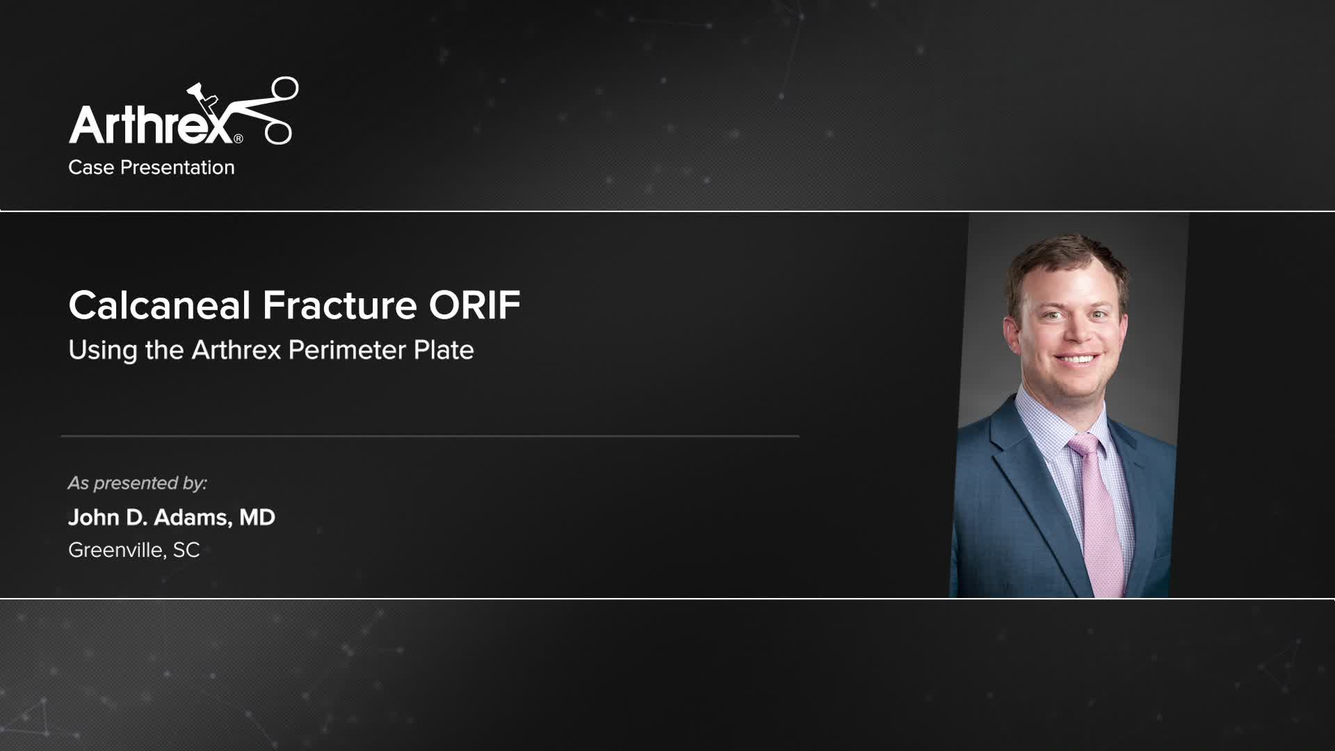 Arthrex - Calcaneal Fracture ORIF Using the Arthrex Perimeter Plate
