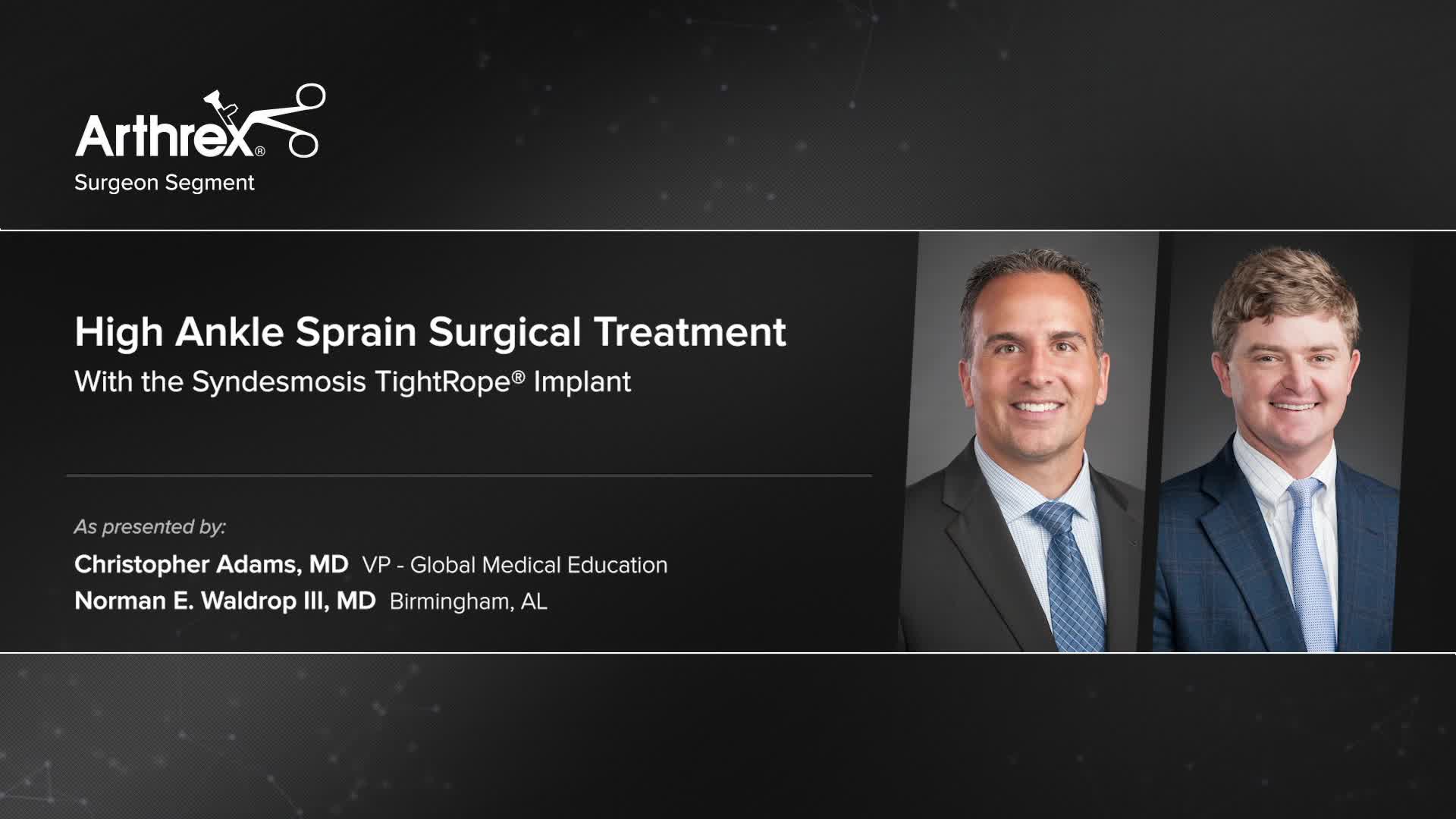Arthrex - High Ankle Sprain Surgical Treatment With the Syndesmosis ...