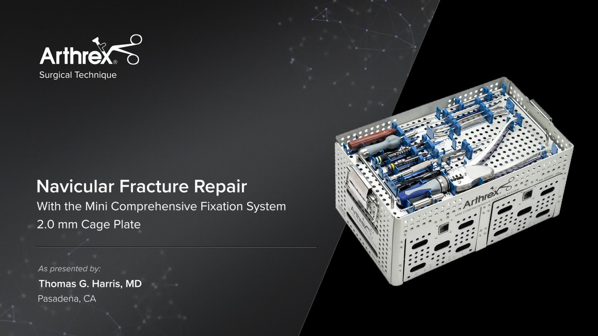 Arthrex - Navicular Fracture Repair With the Mini Comprehensive ...