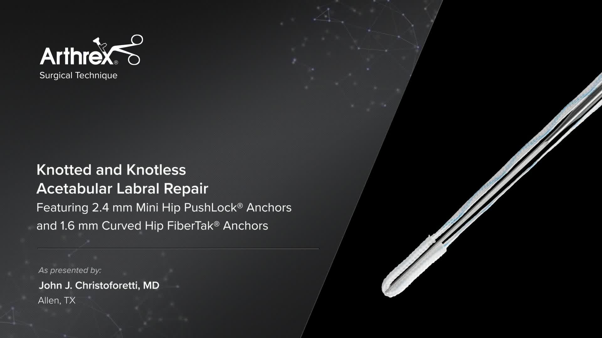 Arthrex Knotted And Knotless Acetabular Labral Repair Featuring 2 4
