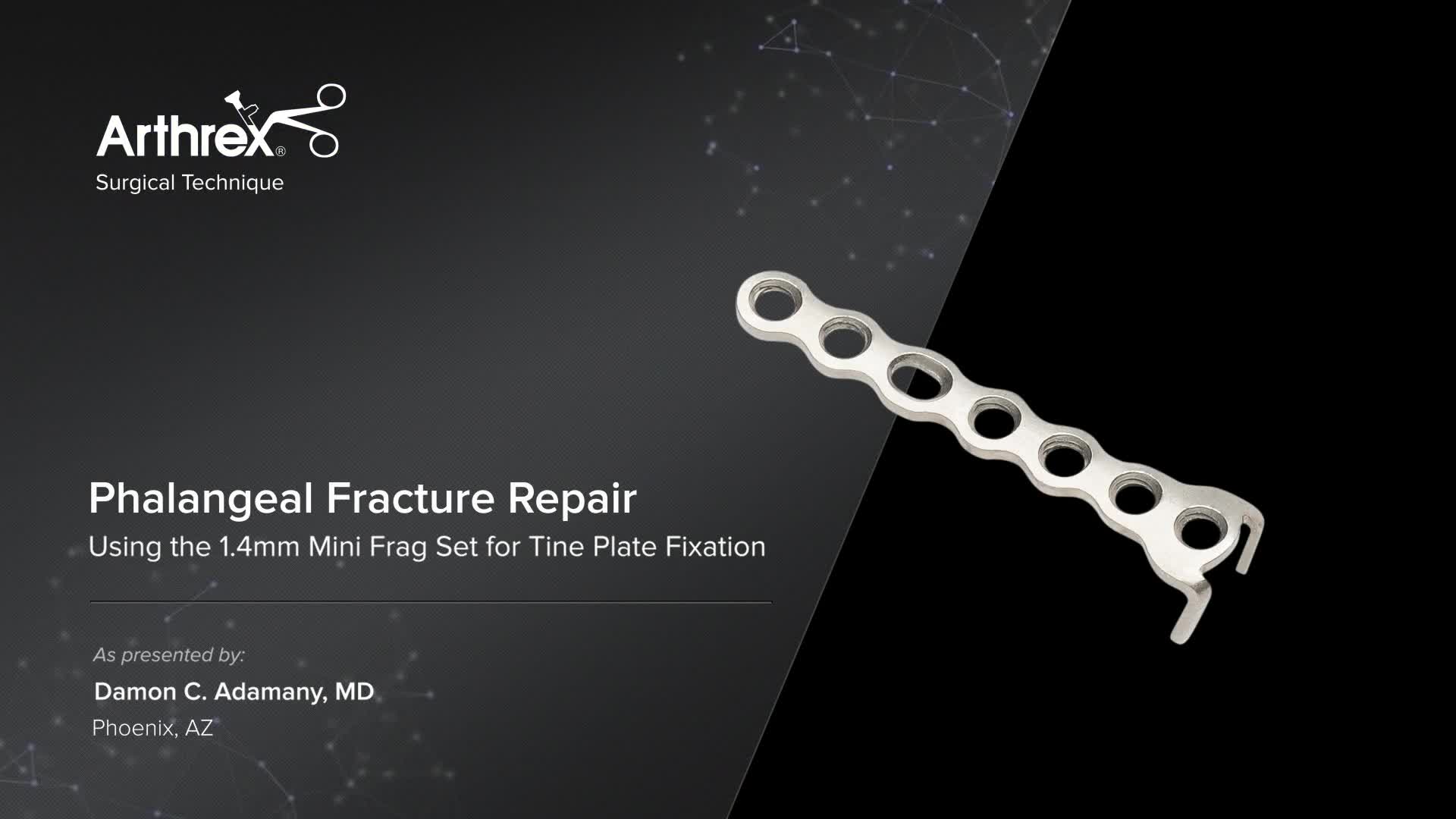 Arthrex - Phalangeal Fracture Repair Using the 1.4mm Mini Frag Set for ...