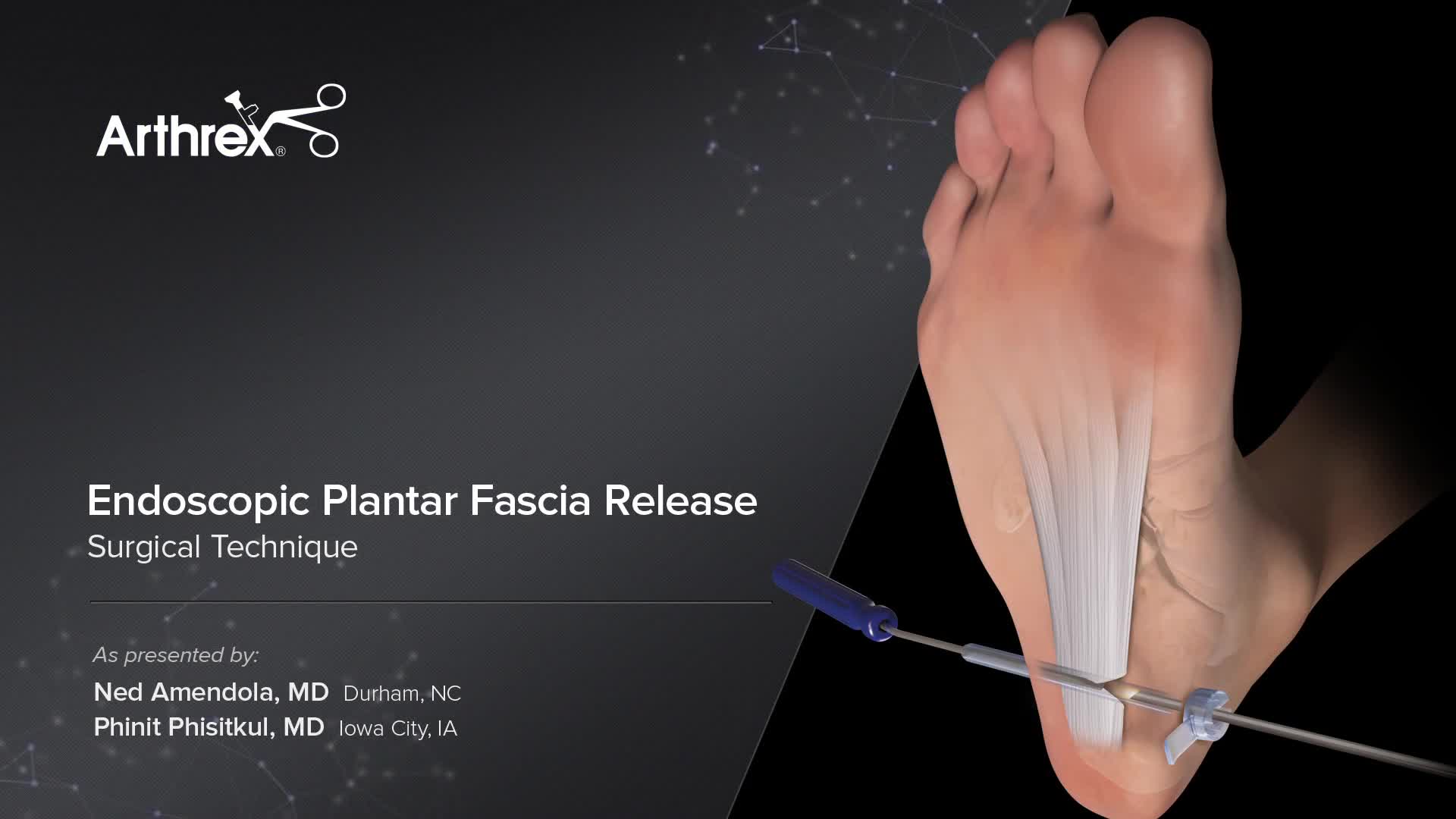 Arthrex - Endoscopic Plantar Fascia Release