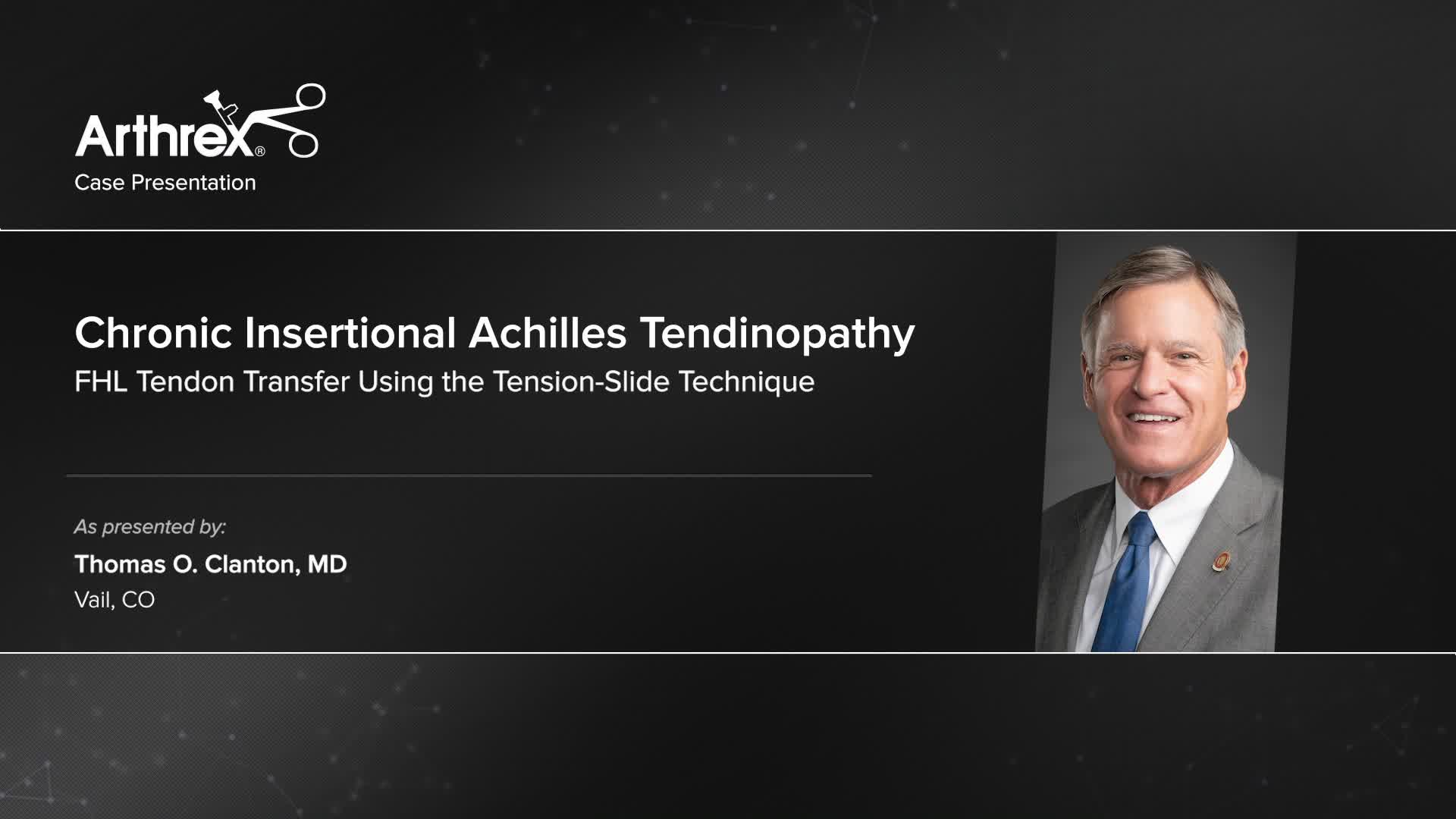 Arthrex - Chronic Insertional Achilles Tendinopathy - FHL Tendon ...