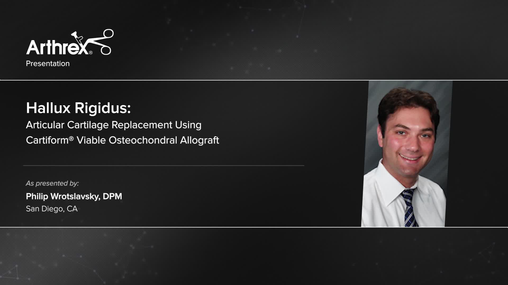 Arthrex - Hallux Rigidus: Articular Cartilage Replacement Using ...