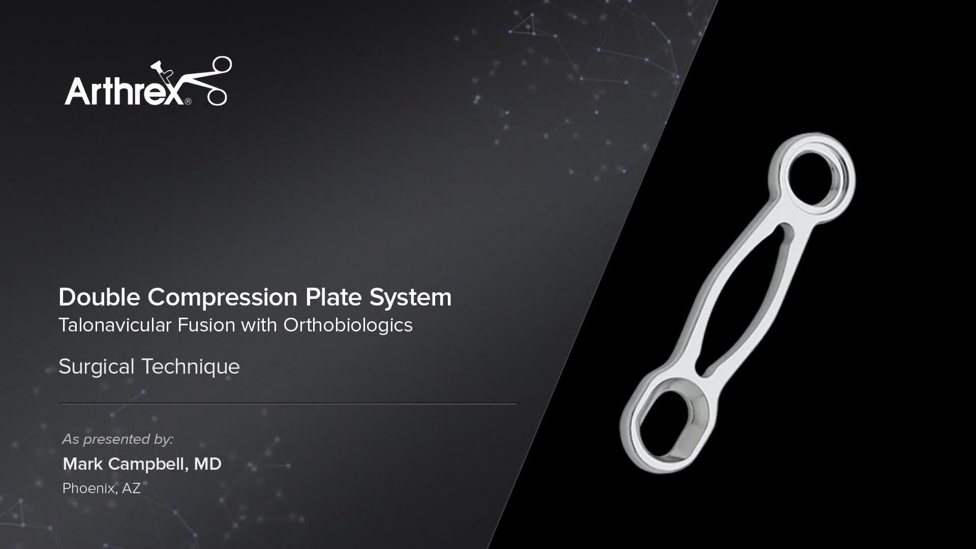 Arthrex - Double Compression Plate System - Talonavicular Fusion with ...