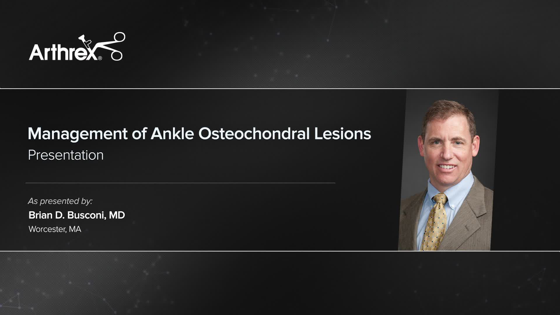 Arthrex - Management of Ankle Osteochondral Lesions