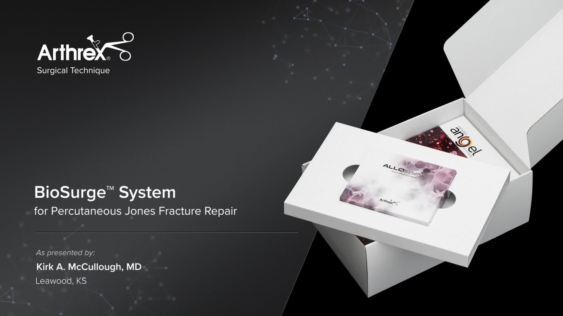 Arthrex - BioSurge™ System for Percutaneous Jones Fracture Repair