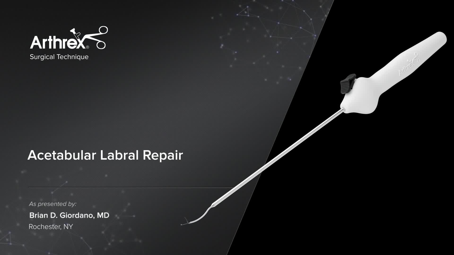 Arthrex - Acetabular Labral Repair