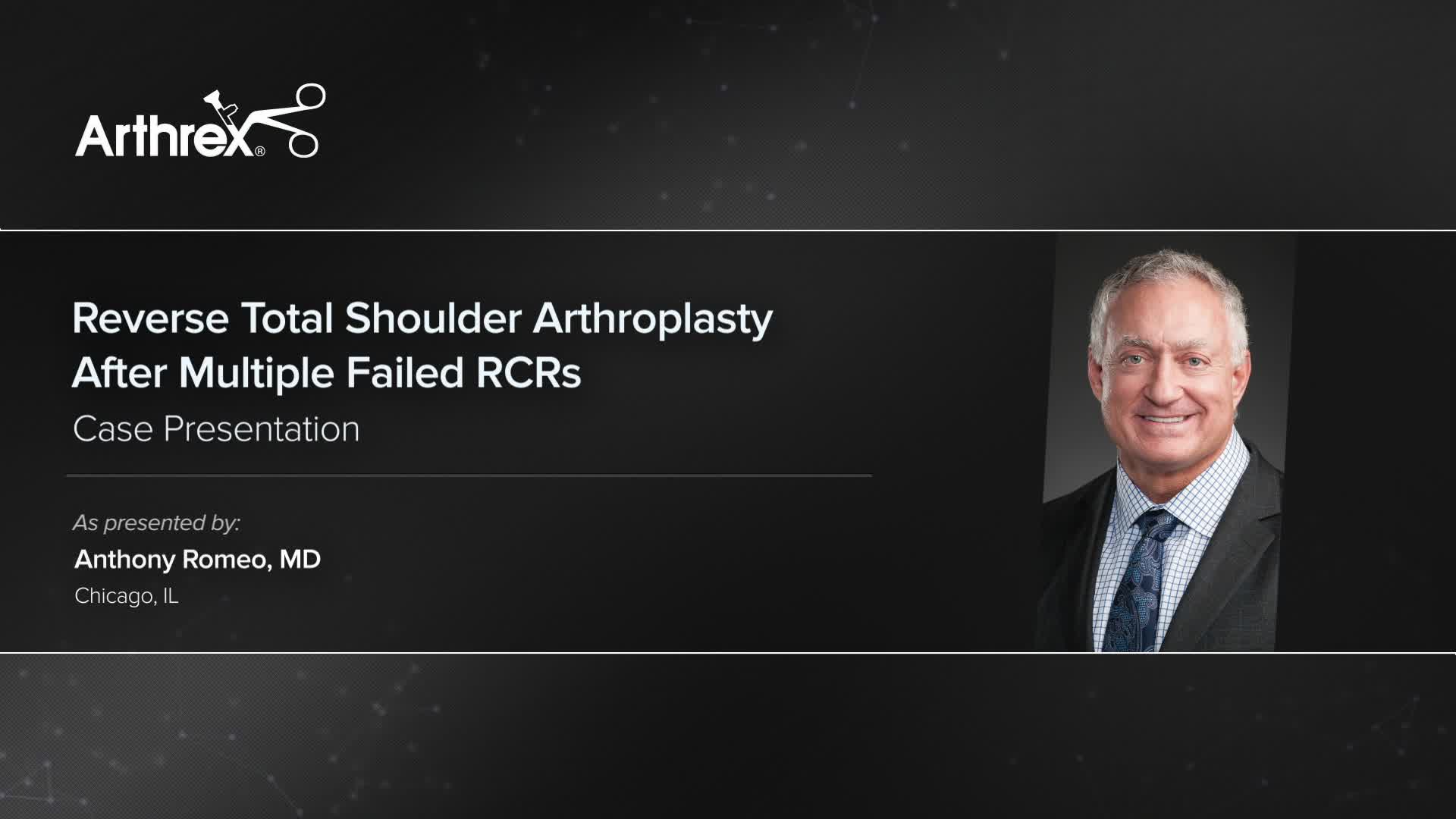 Arthrex - Reverse Total Shoulder Arthroplasty After Multiple Failed RCRs