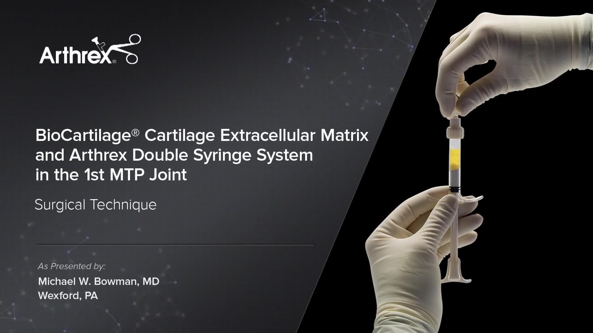Arthrex - BioCartilage® Cartilage Extracellular Matrix and Arthrex ...