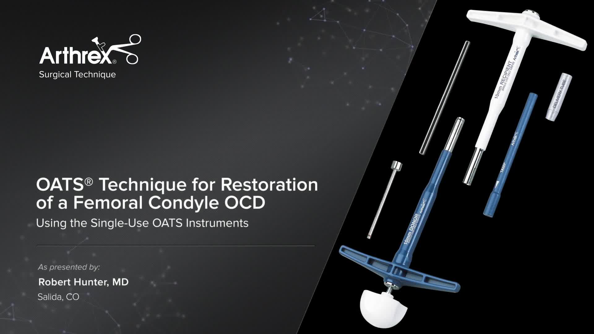 Arthrex - OATS® Technique for Restoration of a Femoral Condyle OCD ...