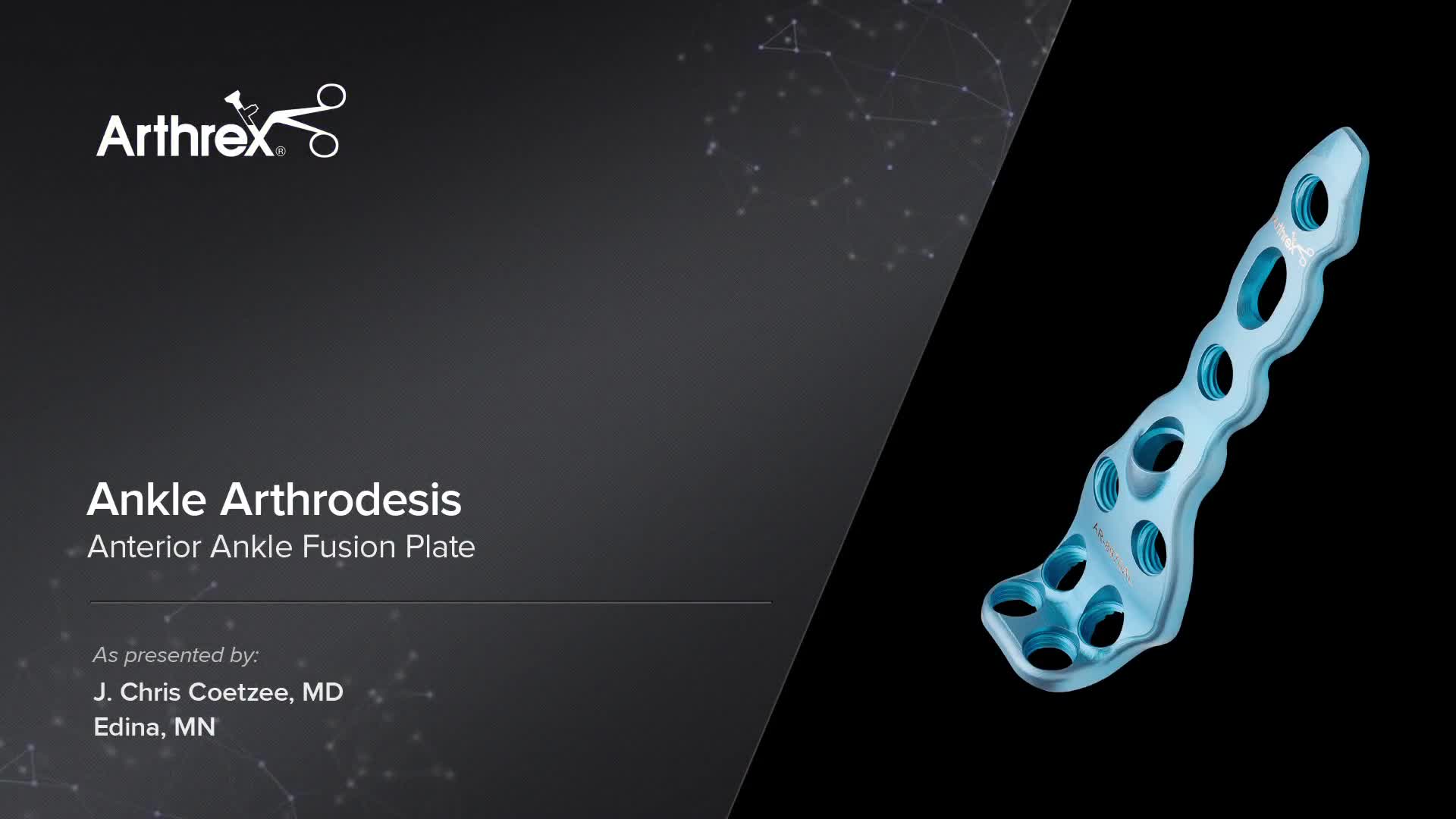 Arthrex - Ankle Arthrodesis - Anterior Ankle Fusion Plate