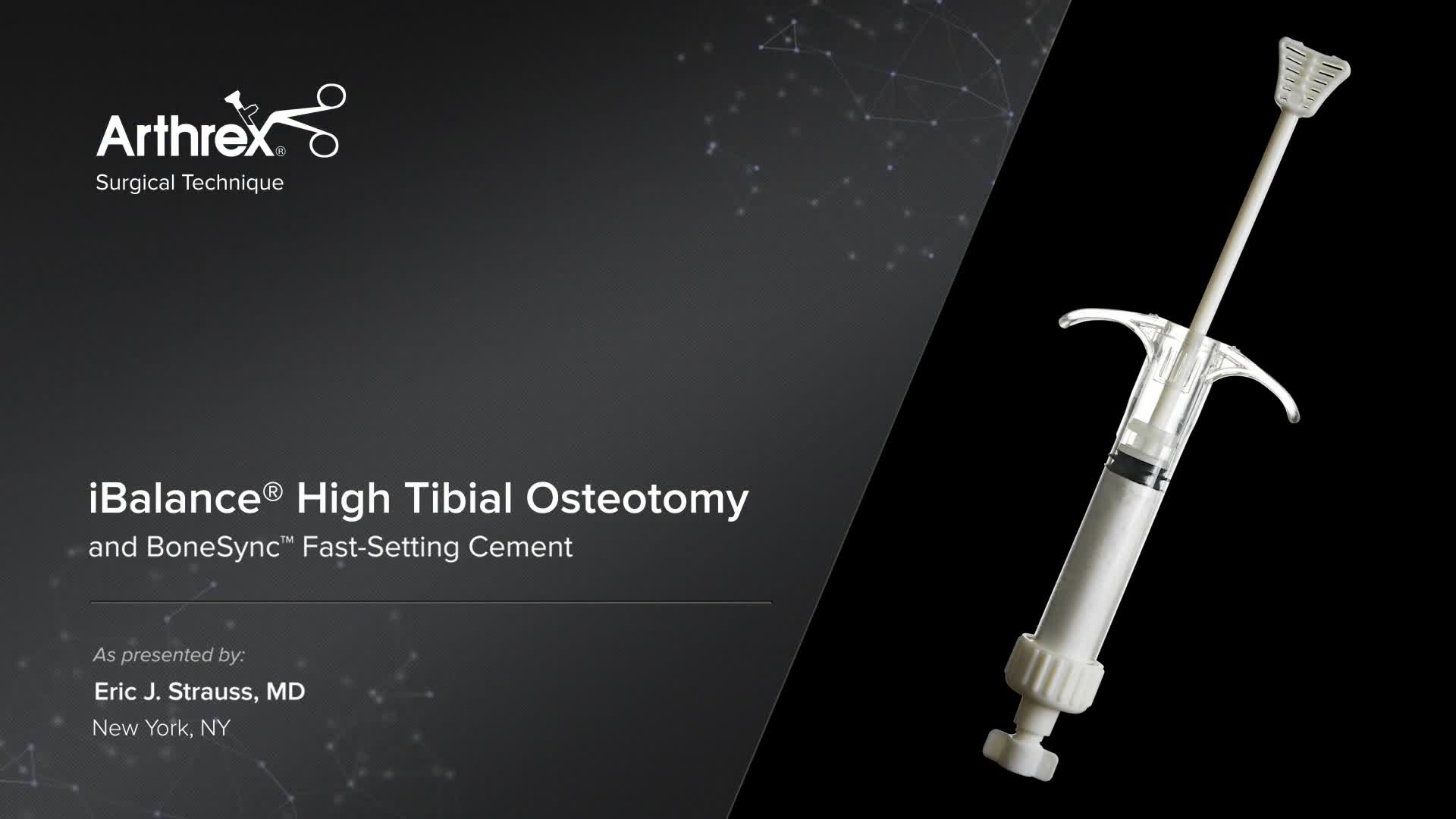 Arthrex - iBalance® High Tibial Osteotomy and BoneSync™ Fast-Setting Cement