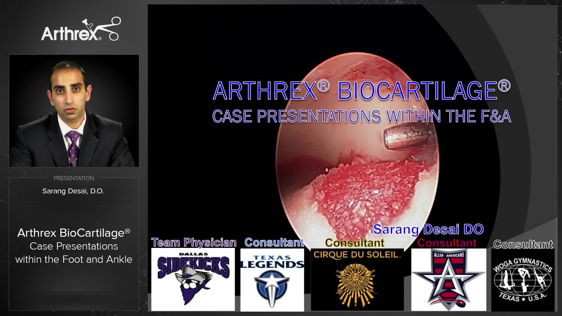 Arthrex - BioCartilage® Foot and Ankle Application