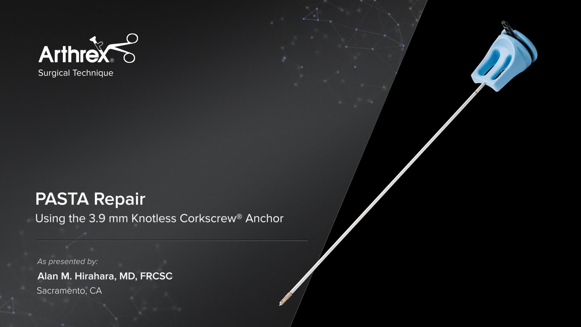 Arthrex - PASTA Repair Using the 3.9 mm Knotless Corkscrew® Anchor