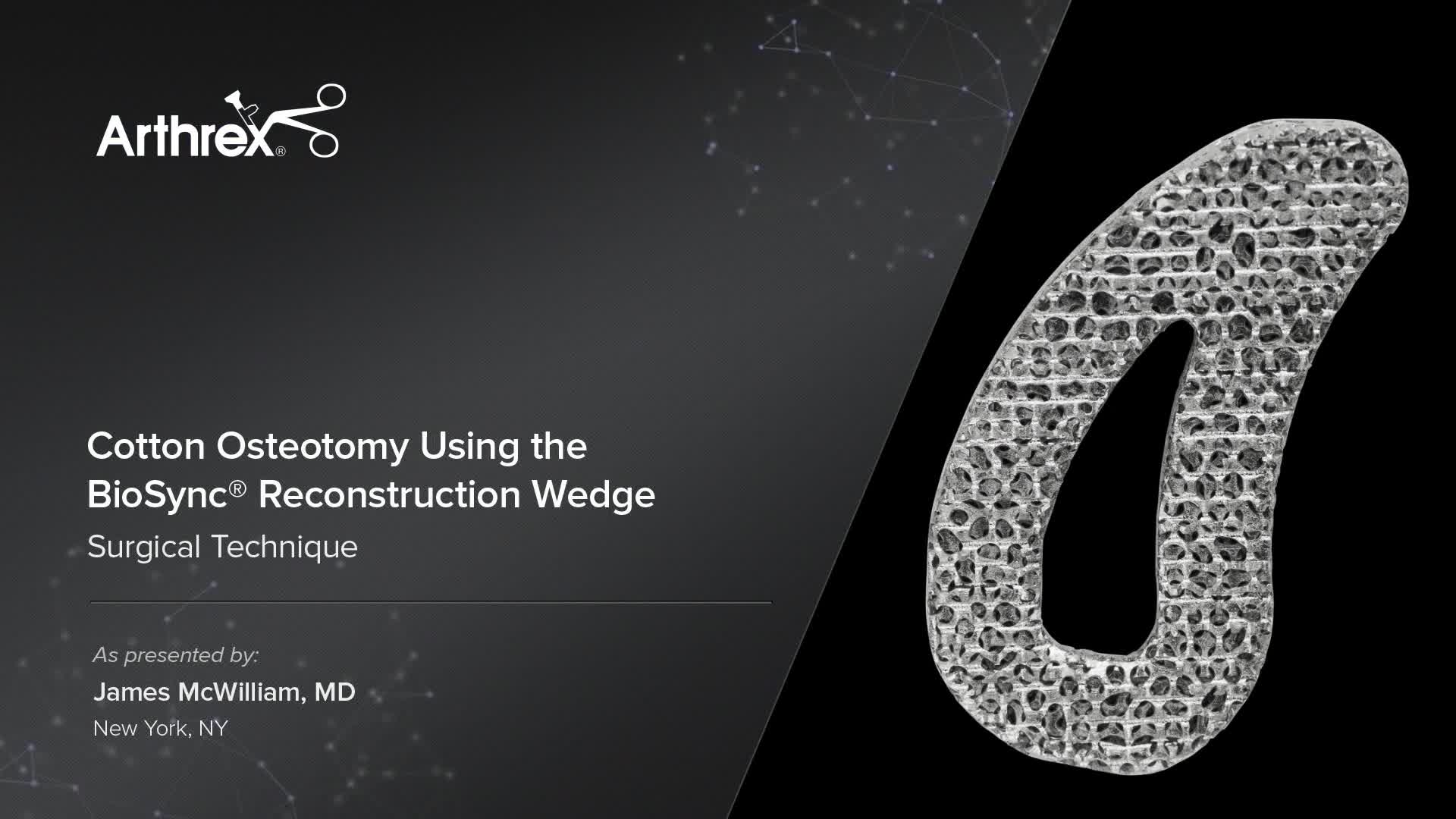 Arthrex - Cotton Osteotomy Using the BioSync® Reconstruction Wedge