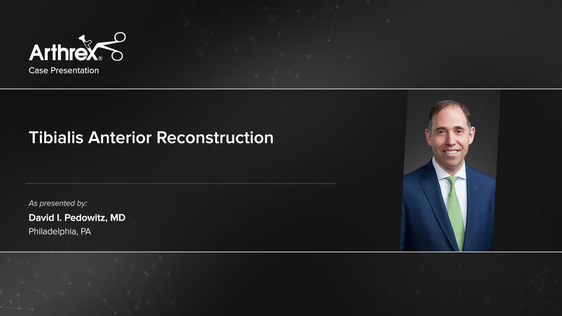 Arthrex - Tibialis Anterior Reconstruction