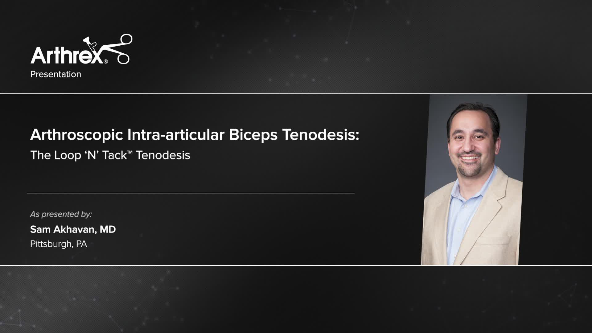 Arthrex - Arthroscopic Intra-articular Biceps Tenodesis: The Loop 'N ...