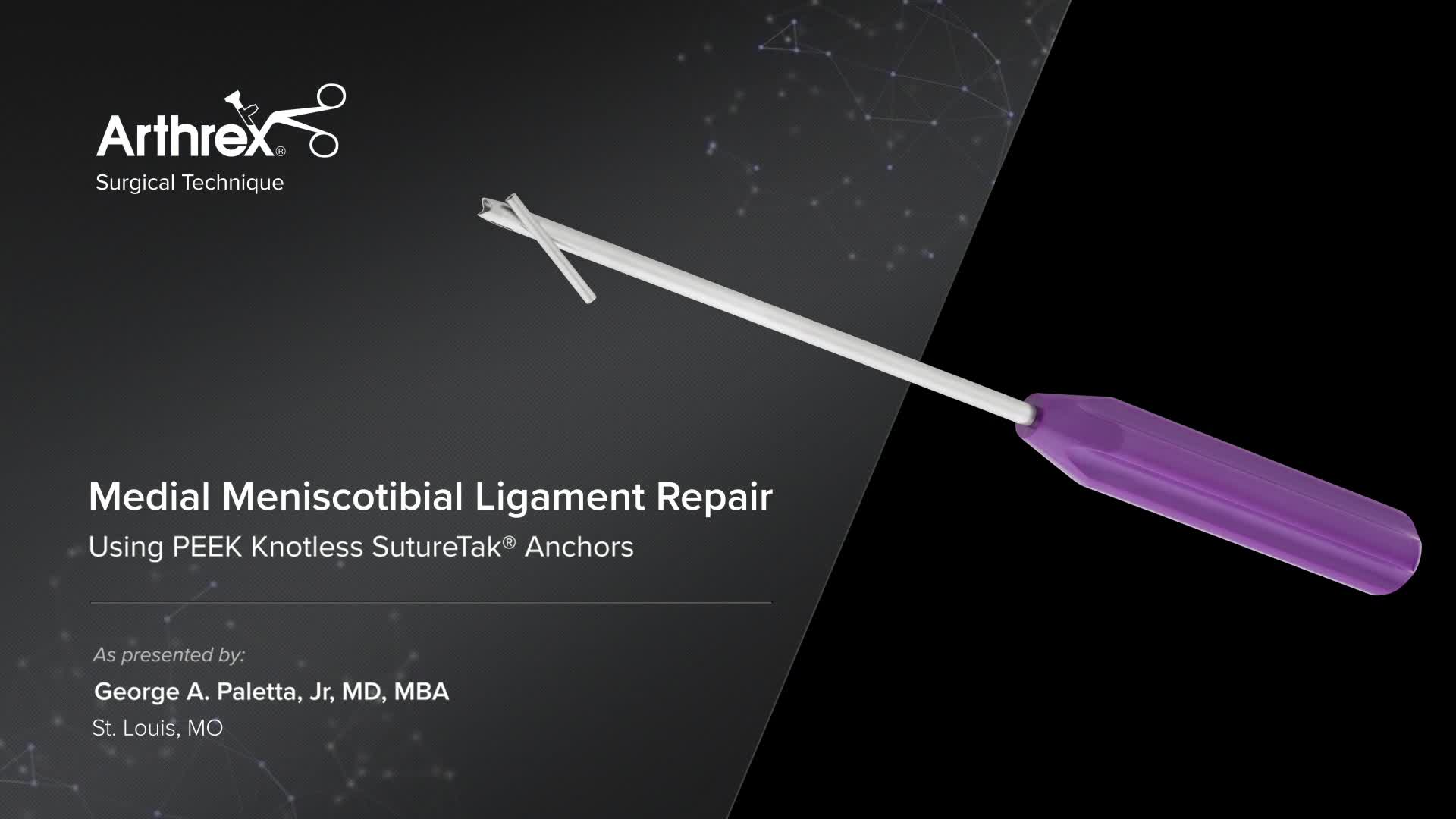 Arthrex - Medial Meniscotibial Ligament Repair Using PEEK Knotless ...