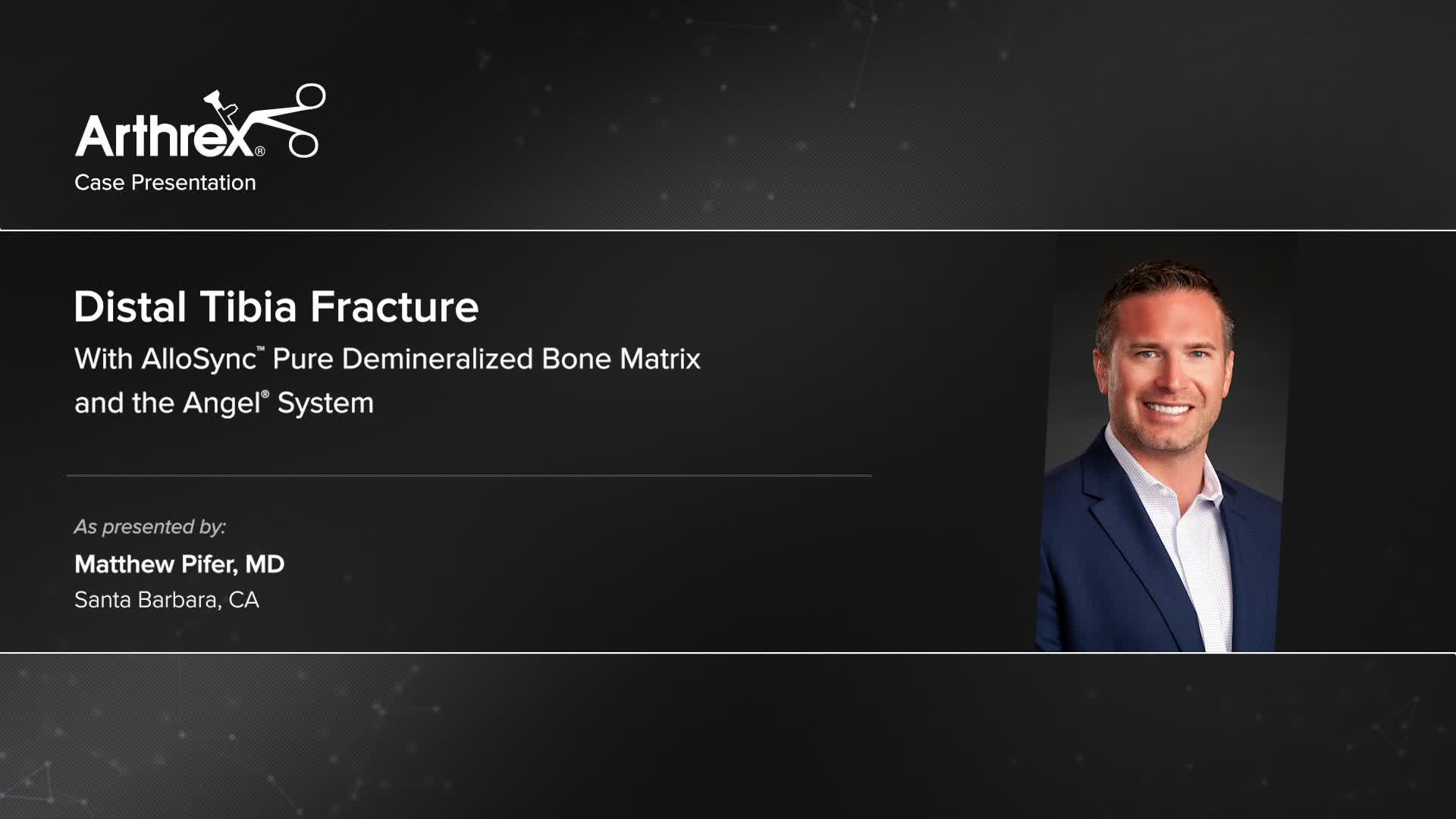 Arthrex - Distal Tibia Fracture With AlloSync™ Pure Demineralized Bone ...