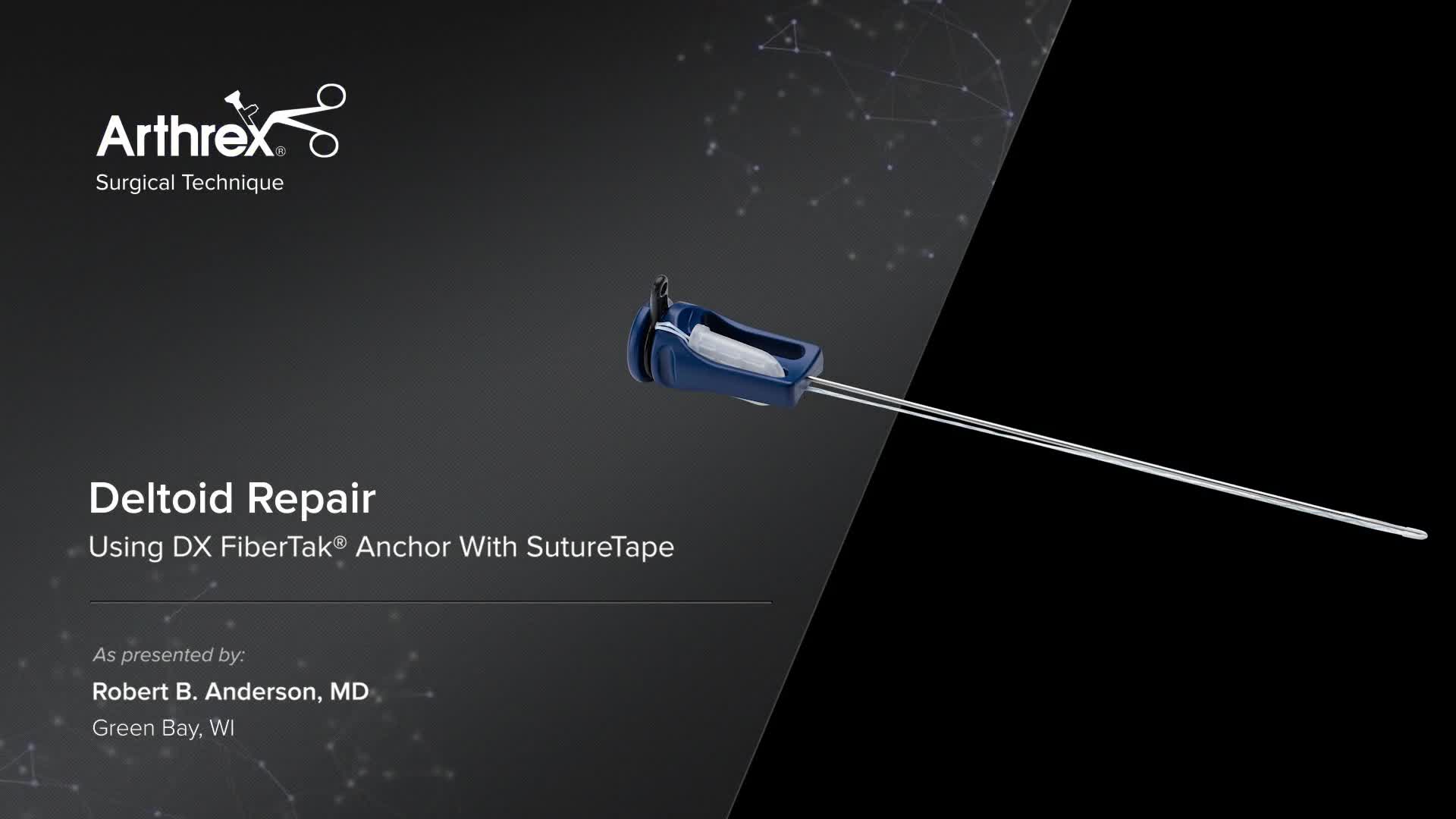 Arthrex - Deltoid Repair Using DX FiberTak® Anchor With SutureTape