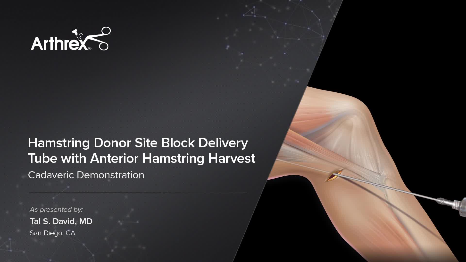 Arthrex - Hamstring Donor Site Delivery Tube with Anterior Hamstring ...