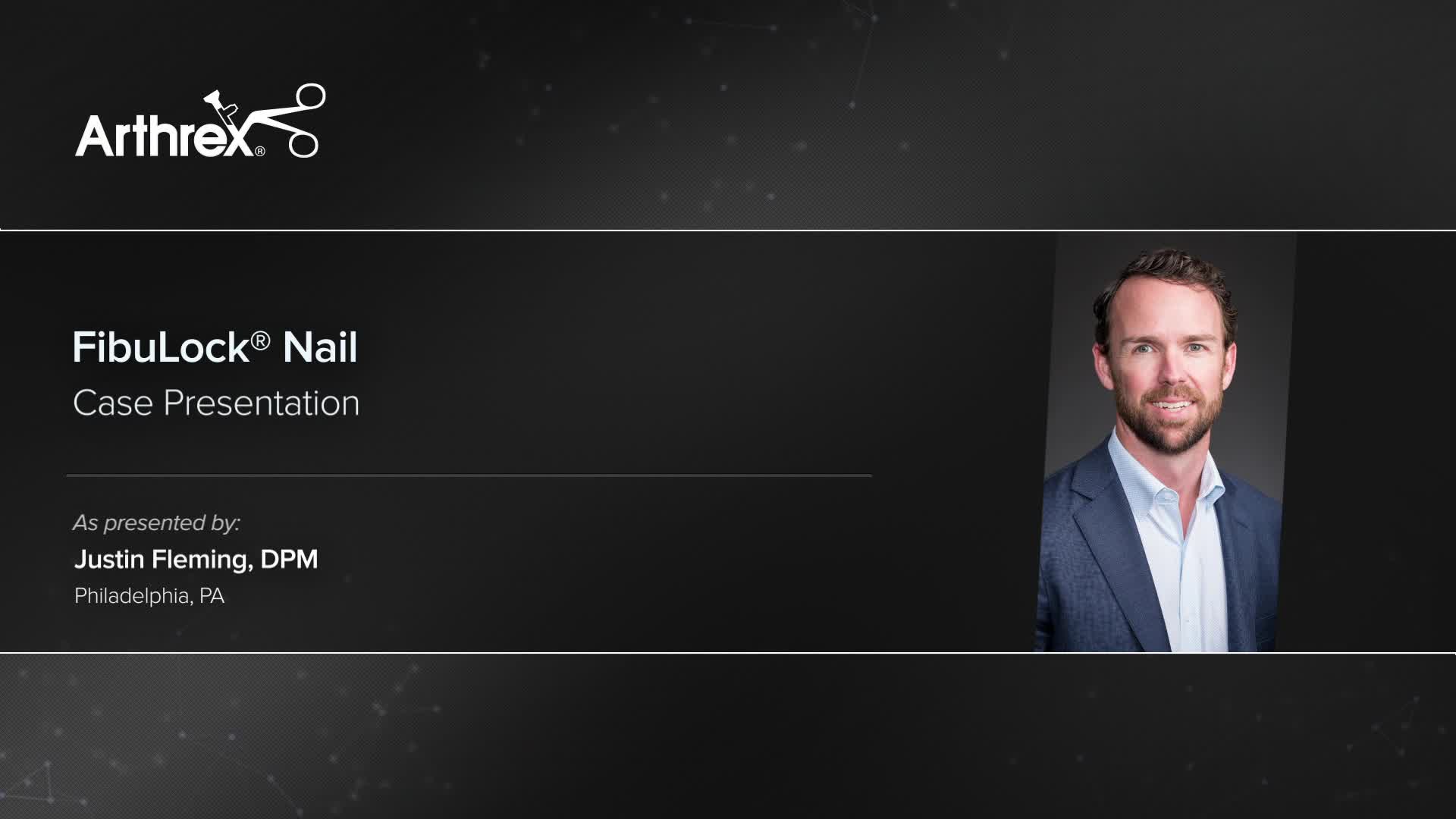 Arthrex - FibuLock® Nail