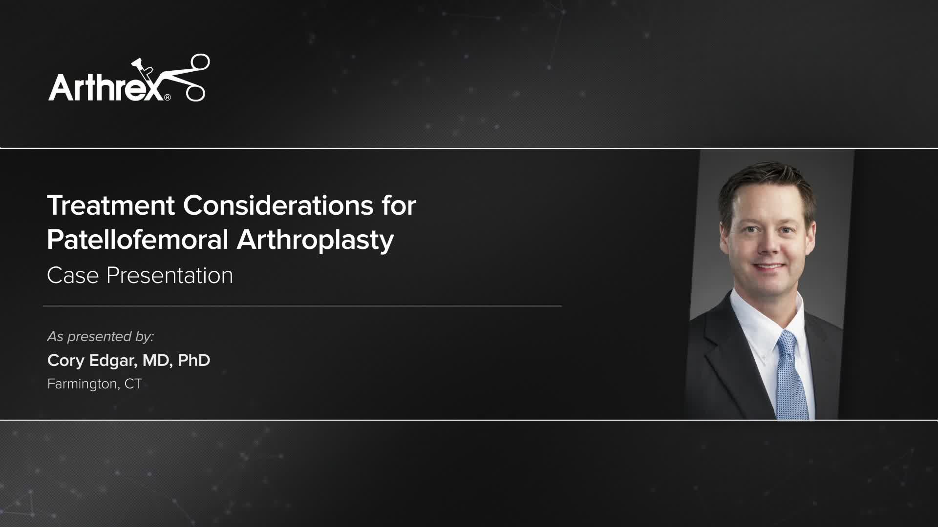 Arthrex - Treatment Considerations for Patellofemoral Arthroplasty