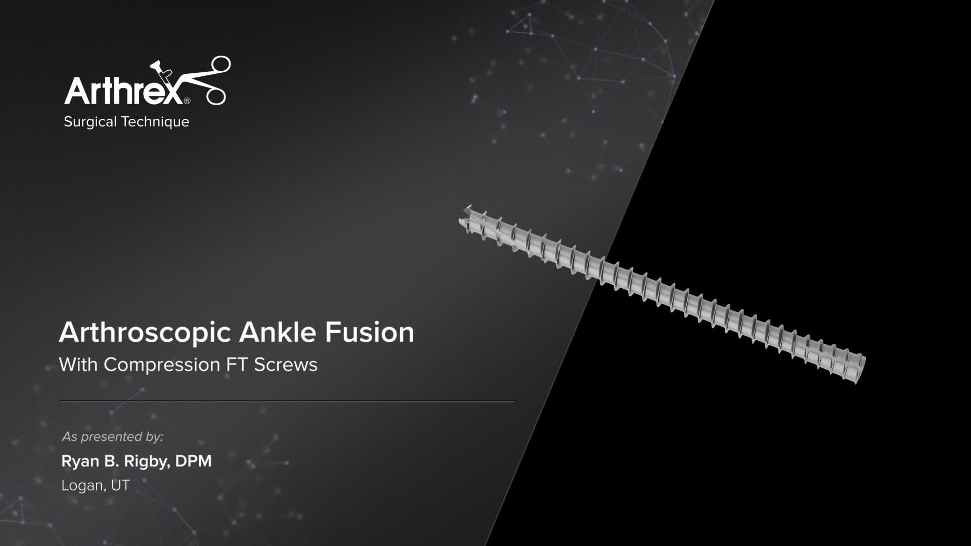 Arthrex - Arthroscopic Ankle Fusion With Compression FT Screws