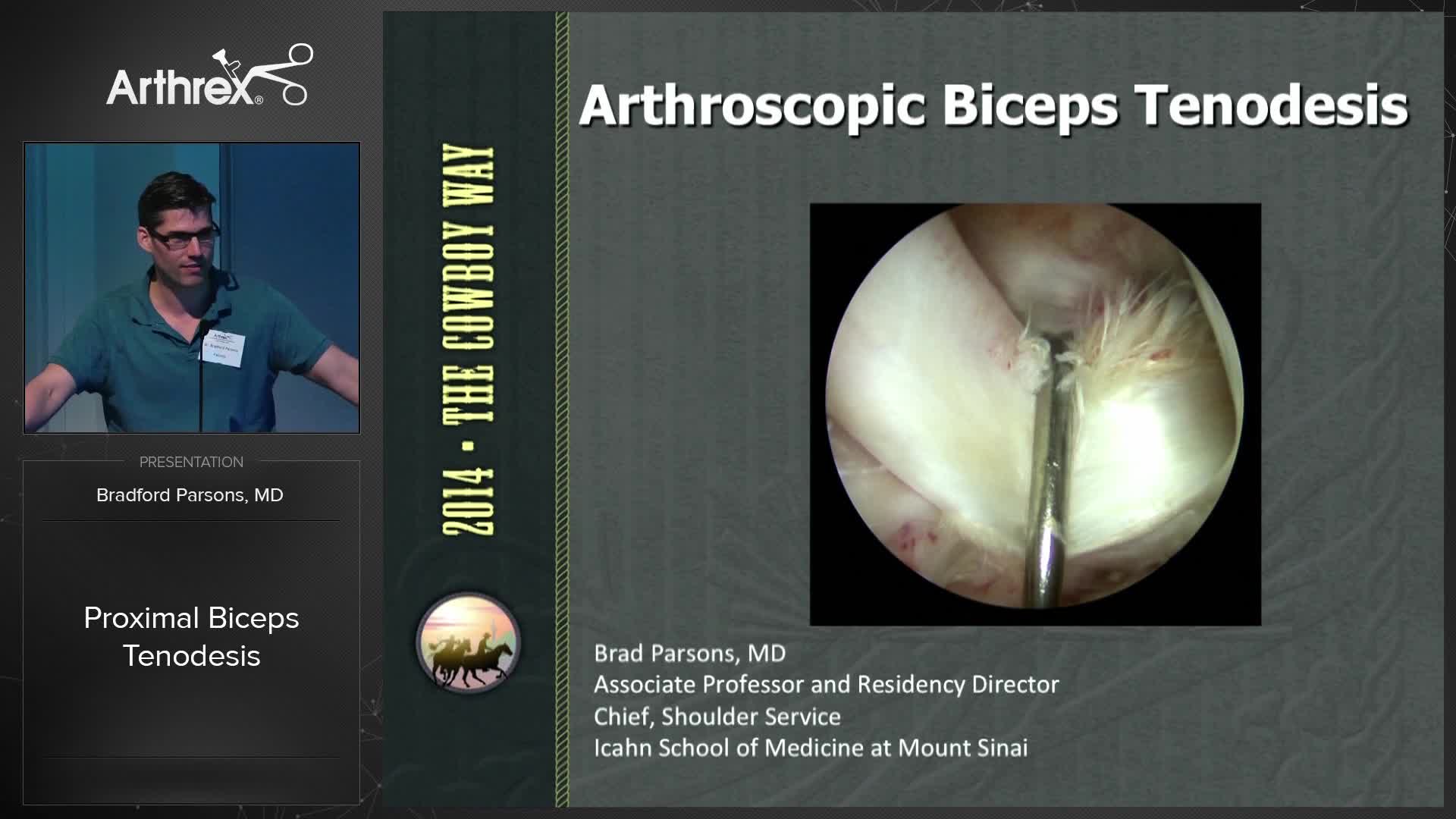 Arthrex - Proximal Biceps Tenodesis