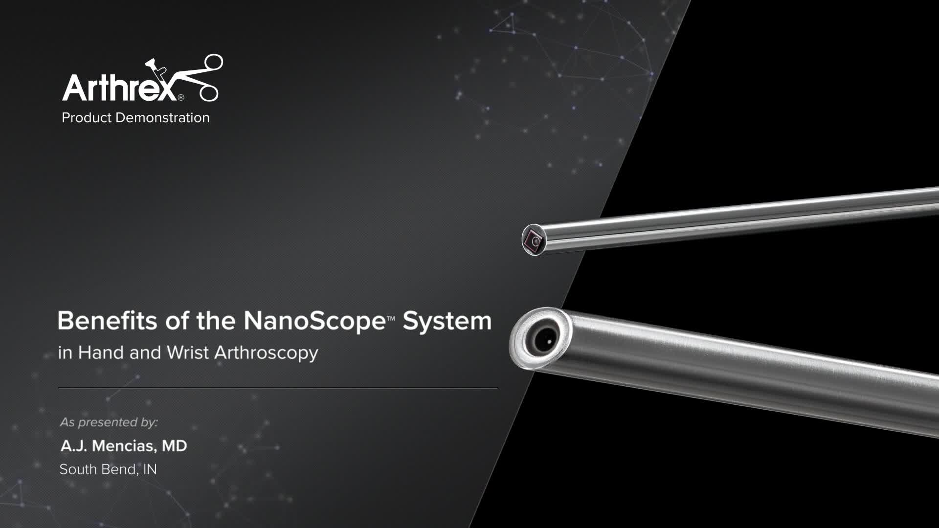 Arthrex - Benefits of the NanoScope™ System in Hand and Wrist Arthroscopy
